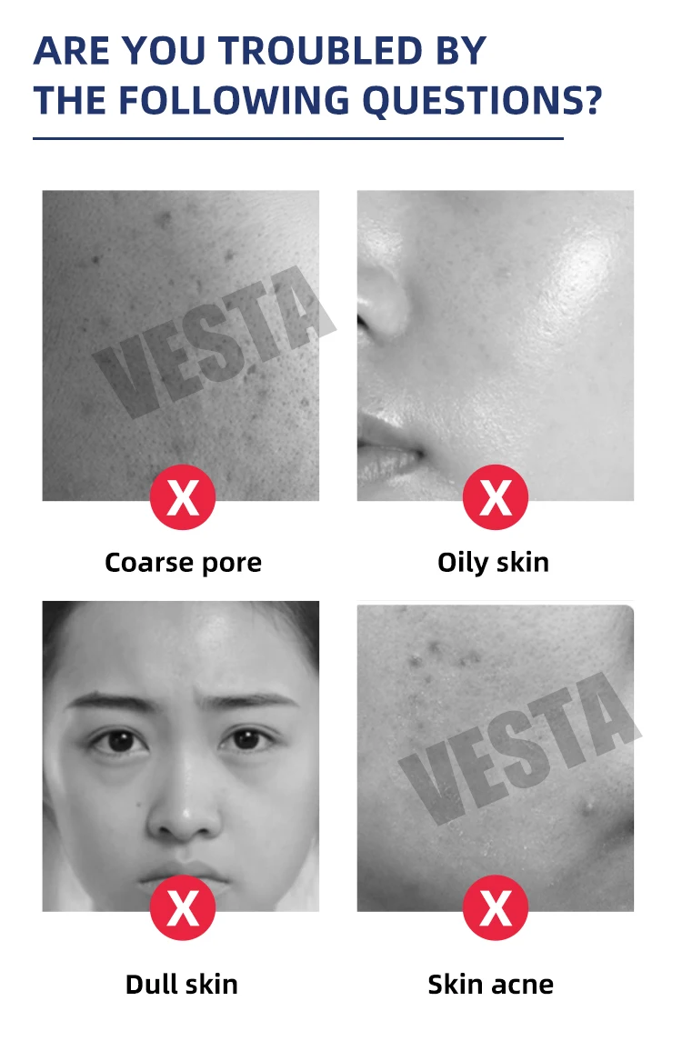 Hydra Oxygen Small Bubble Skin Care Machine Ultrasonic Vacuum Face ...