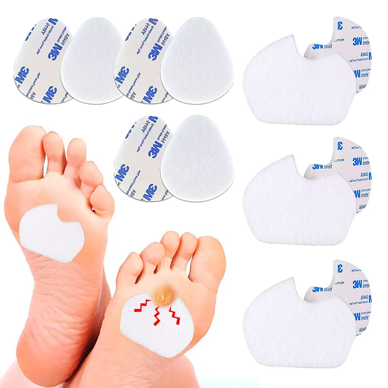Sesamoiditis Pad