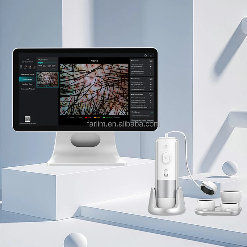 Portable 3D Skin Analyzer Hair Scalp Machine Hair Scalp Scanner for ...