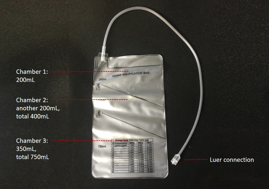 Ozone Bag 3 Chamber - Versatile Insufflation Solutions