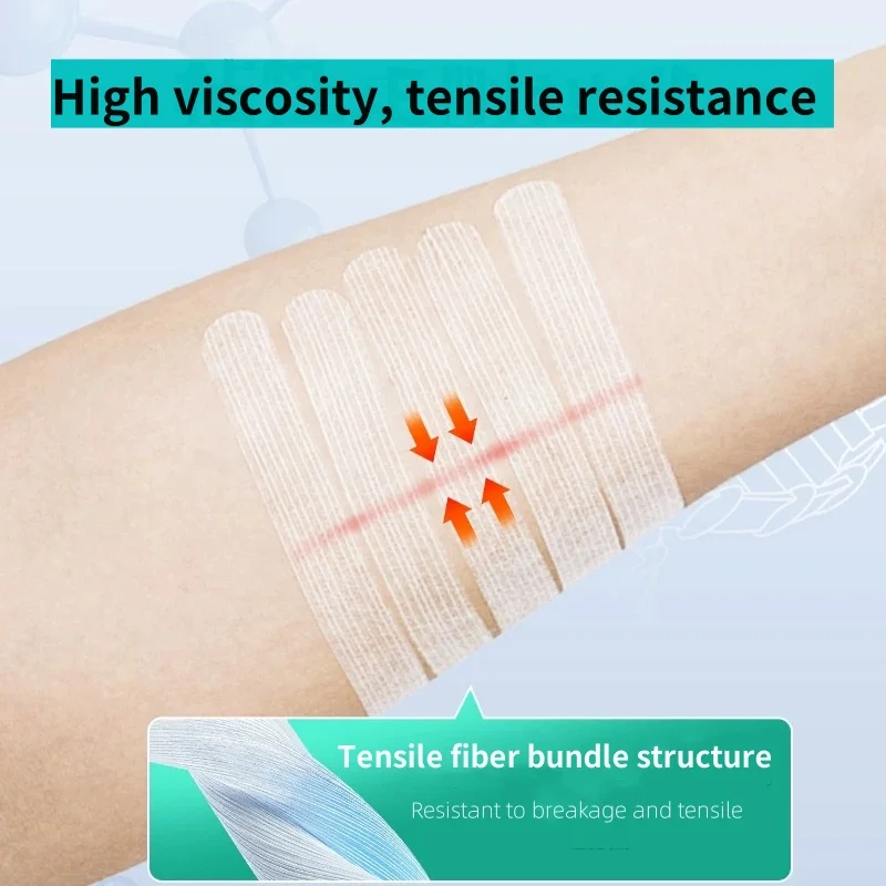 Surgical Wound Steri-strip Tape Medical Skin Closures With Different ...
