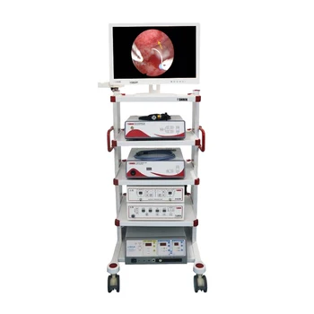 Shrek Medical Hd Endoscopic Camera Uretroscope Camera System - Buy Hd ...