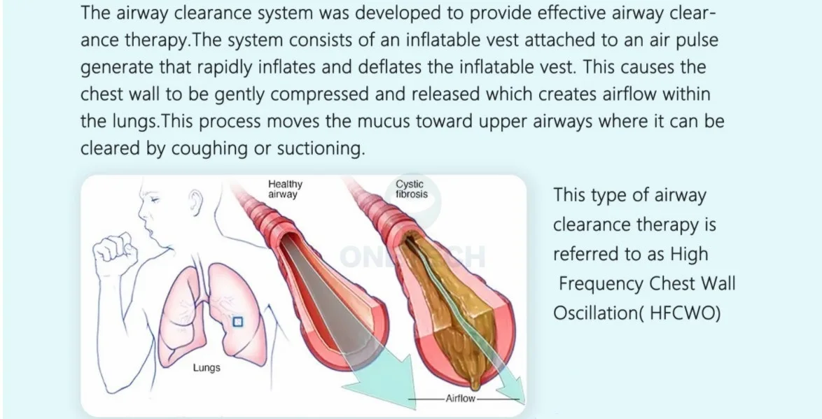 As10 Vest Airway Clearance System Respiratory Care Device Treat For ...