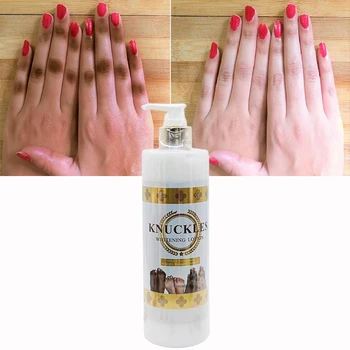 Strong Fast Whitening Body Lotion Cream Remove Dark Knuckle Knee Elbow ...