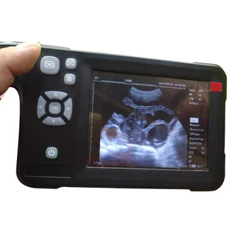 Pig Portable B Ultrasound Scanner Livestock Pregnancy Test Machine ...