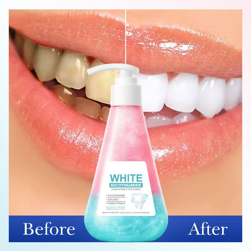 Colorful Whitening Toothpaste Remove Tooth Stains Clean Teeth Oral Care Soda Probiotics ...