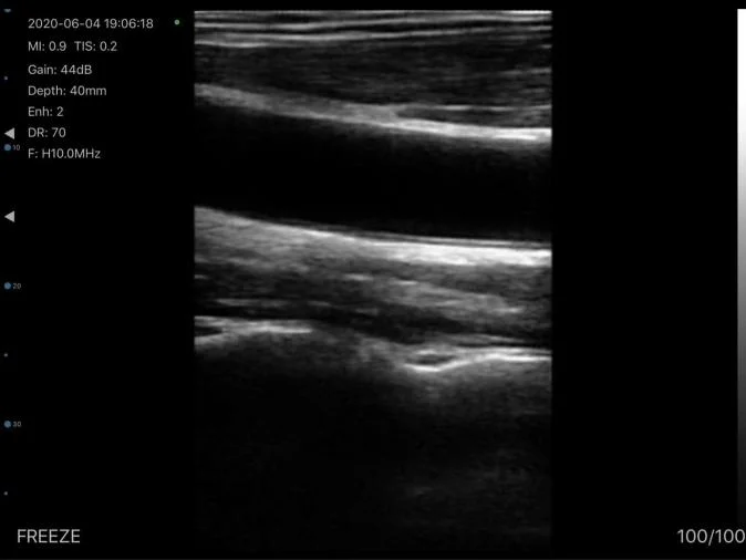 3 in 1 Color Doppler Ultrasound Probe - Versatile & Reliable