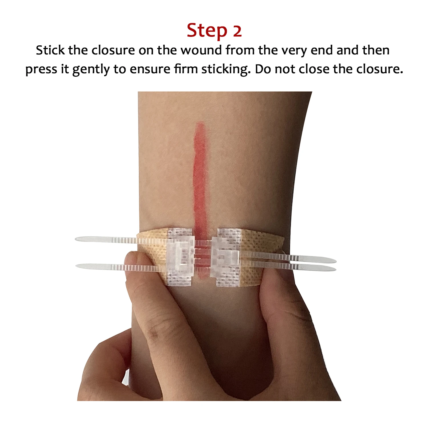 Medical Surgical Sterile Adhesive Emergency Wound Closures Strips - Buy ...