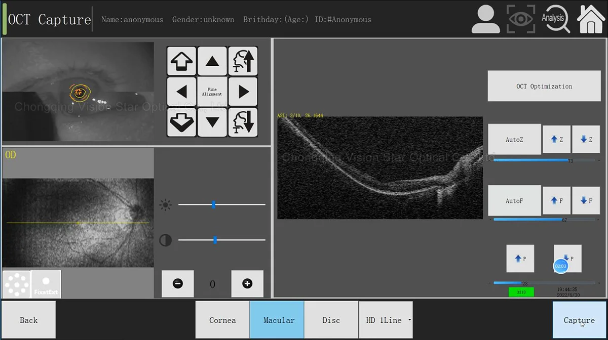 Retiview-500 OCT Machine for Eye Exams - 1 Year Warranty