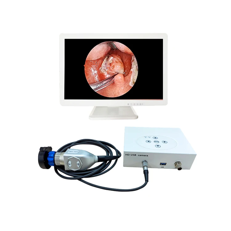 Medical Endoscope Hd Usb Portable Ent Camera And Urology Cystoscopy ...