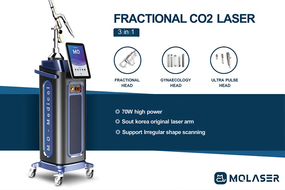 CO2 Fractional Laser for Acne Scars - Professional Results