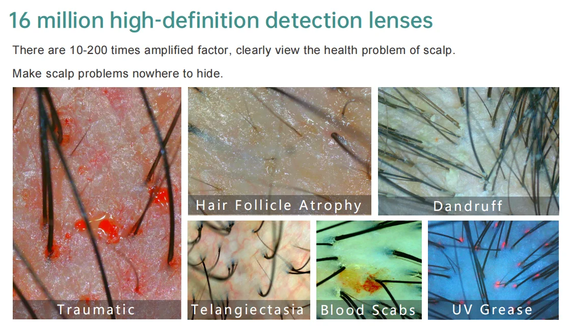 HD Microscope AI Hair Analyzer 3D Desktop Scalp Scanner Skin Detector ...