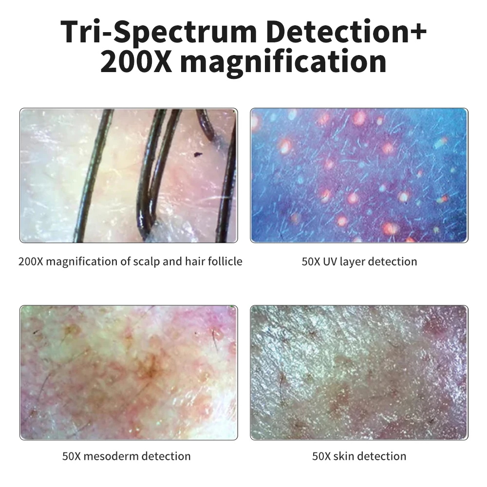 High Quality Hd Hair Follicles Scalp Scanner Detector Hair Analyzer ...