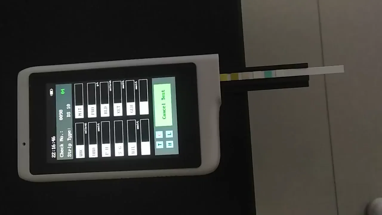 Portable Urine Analyzer,Urine Routine Testing,Household,Medical ...