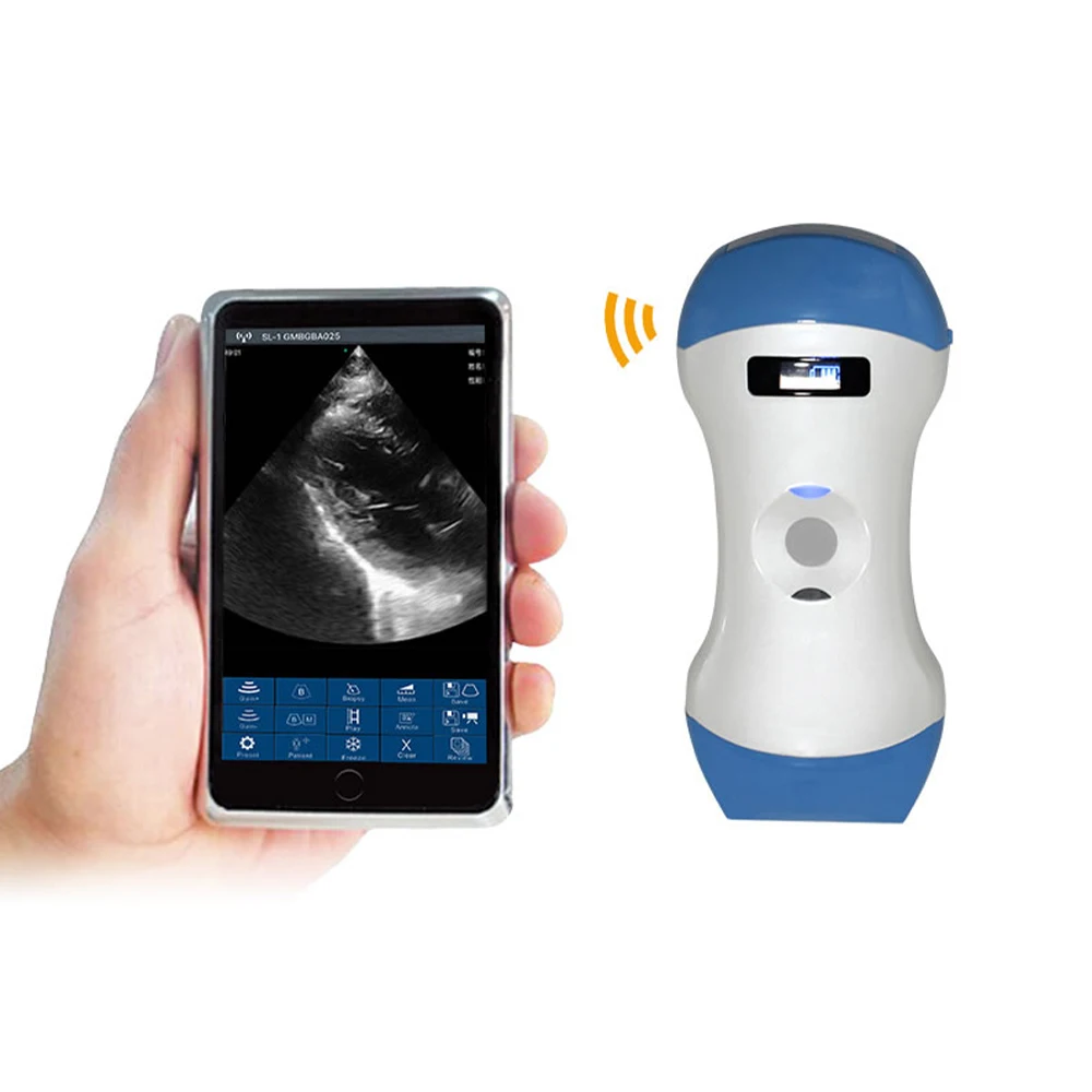 Suresult Wireless Phased Array Ultrasound System For Medical Multi ...