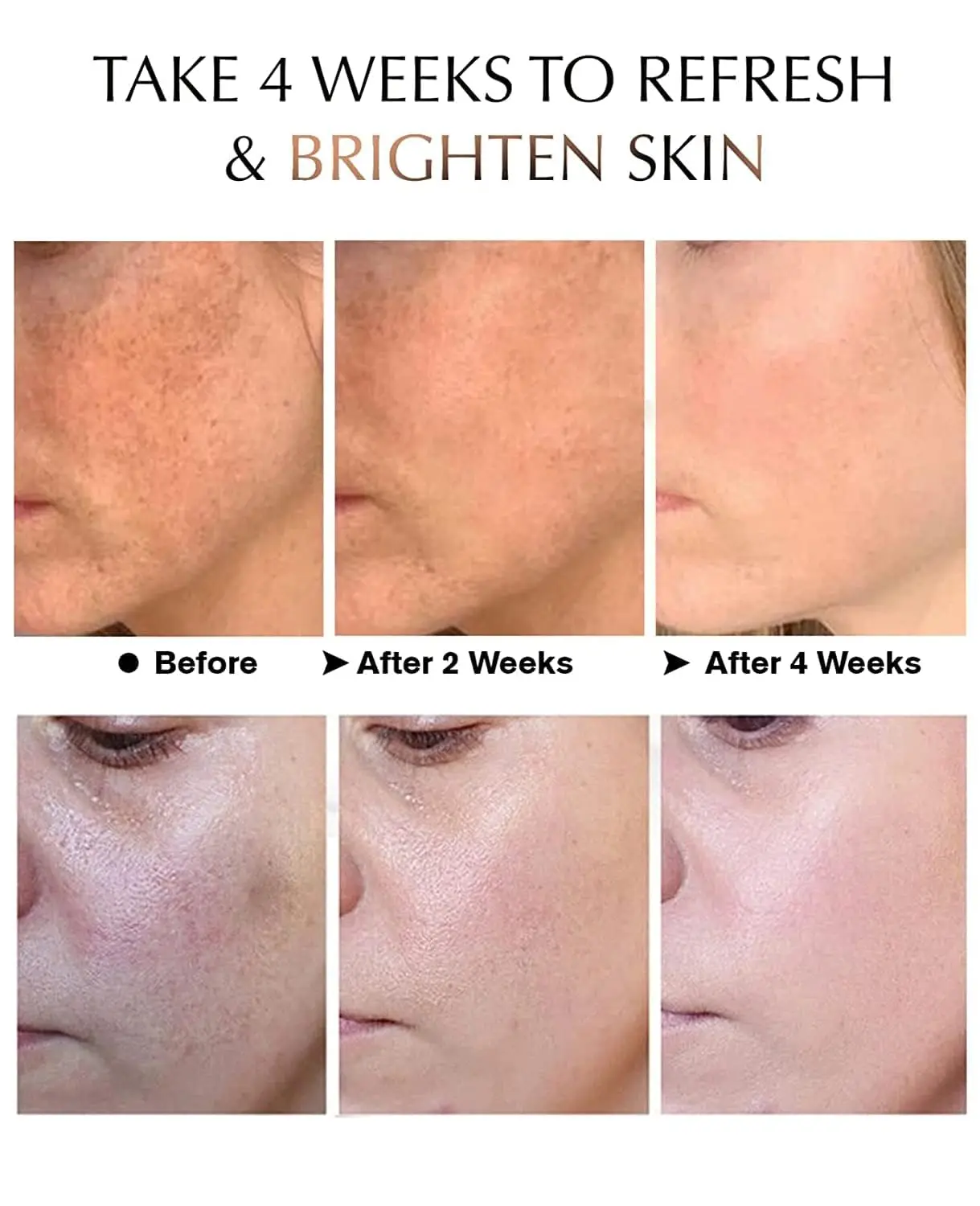 Snow Bleach Cream for Private Part - Whitening & Moisturizing