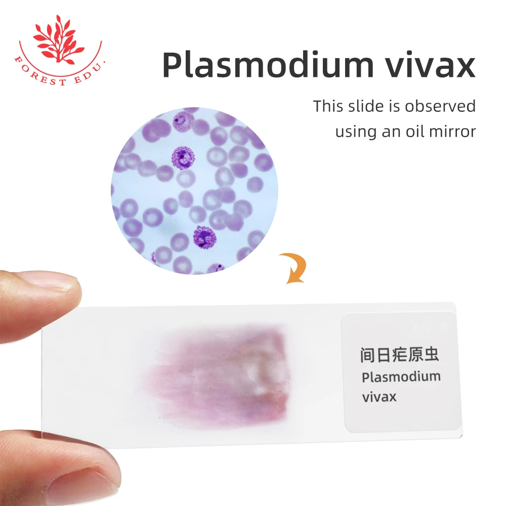 Plasmodium Vivax Blood Smears Medical Research - Parasite Microscopy Observation And Loading ...