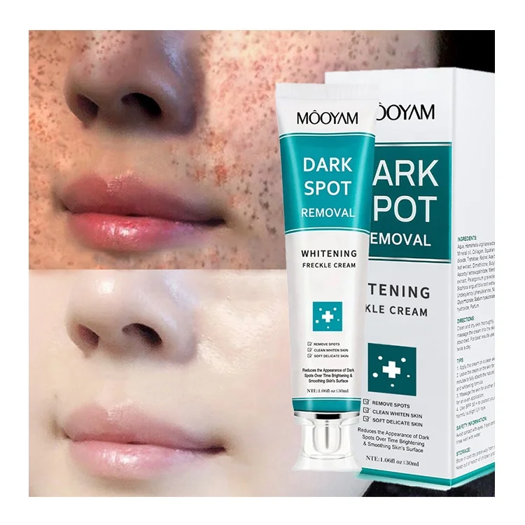 7 Days Dark Spots Anti Freckle Whitening Cream Strong Powerful Dark Spot Removal Cream - Buy ...