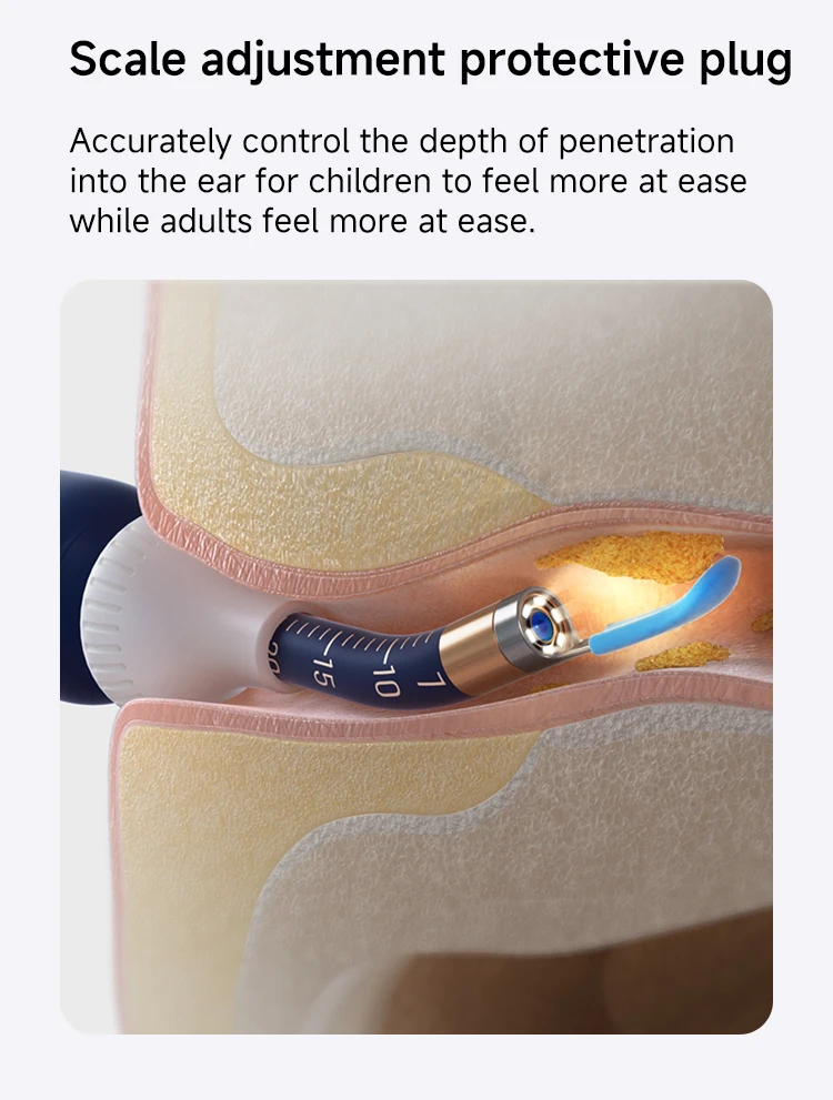 Bebird Earsight Plus - Advanced Ear Wax Removal Tool