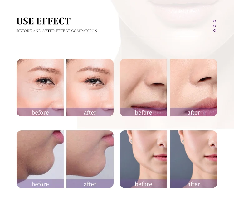 High Quality V Face Shaper Lift Up Belt Lifting Mask Face Lifting Neck ...