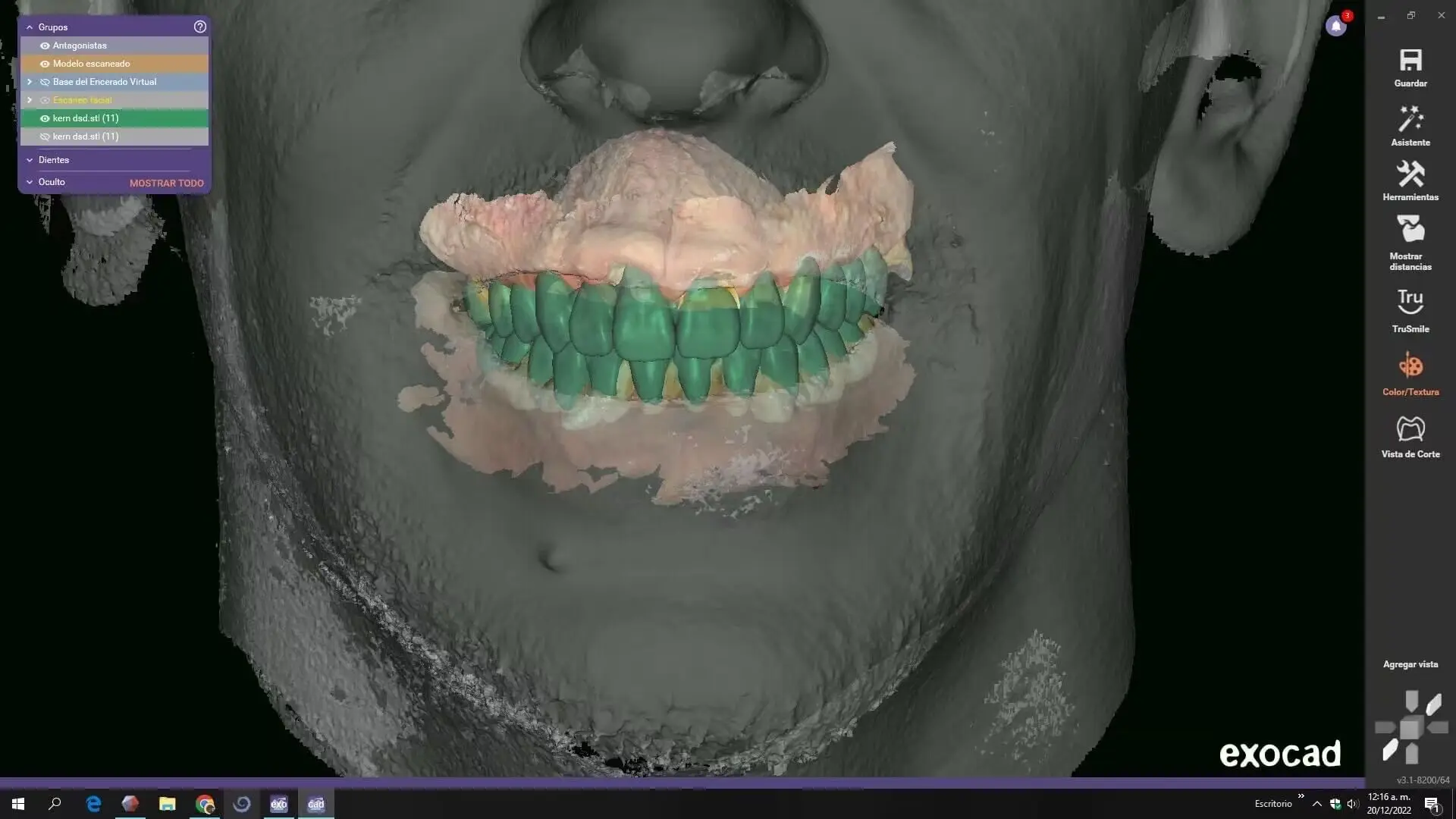 Affordable 3d Scanner Face Body Scan Full Arch Design Restorative ...