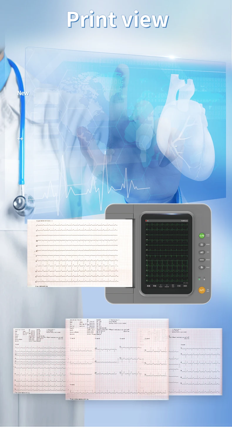 CONTEC E12 12 Channel ECG Machine - Quality and Reliability