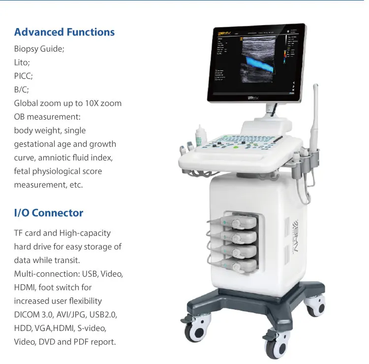 Pregnancy Scanner Ultrasound Diagnostic System - BMV BPU90