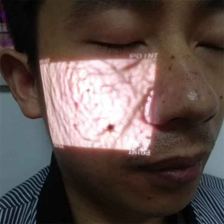 Ultraviolet Light to See Veins Scanner Find Vain Finder Medical ...