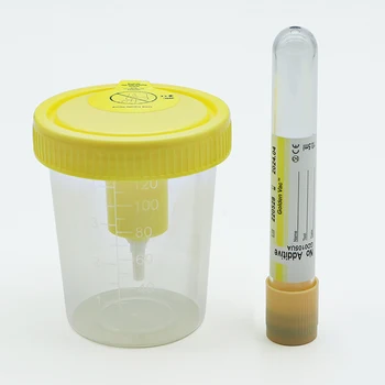 Medical Use Specimen Container 120ml Graduated Urine Collection Cup Disposable Container With ...