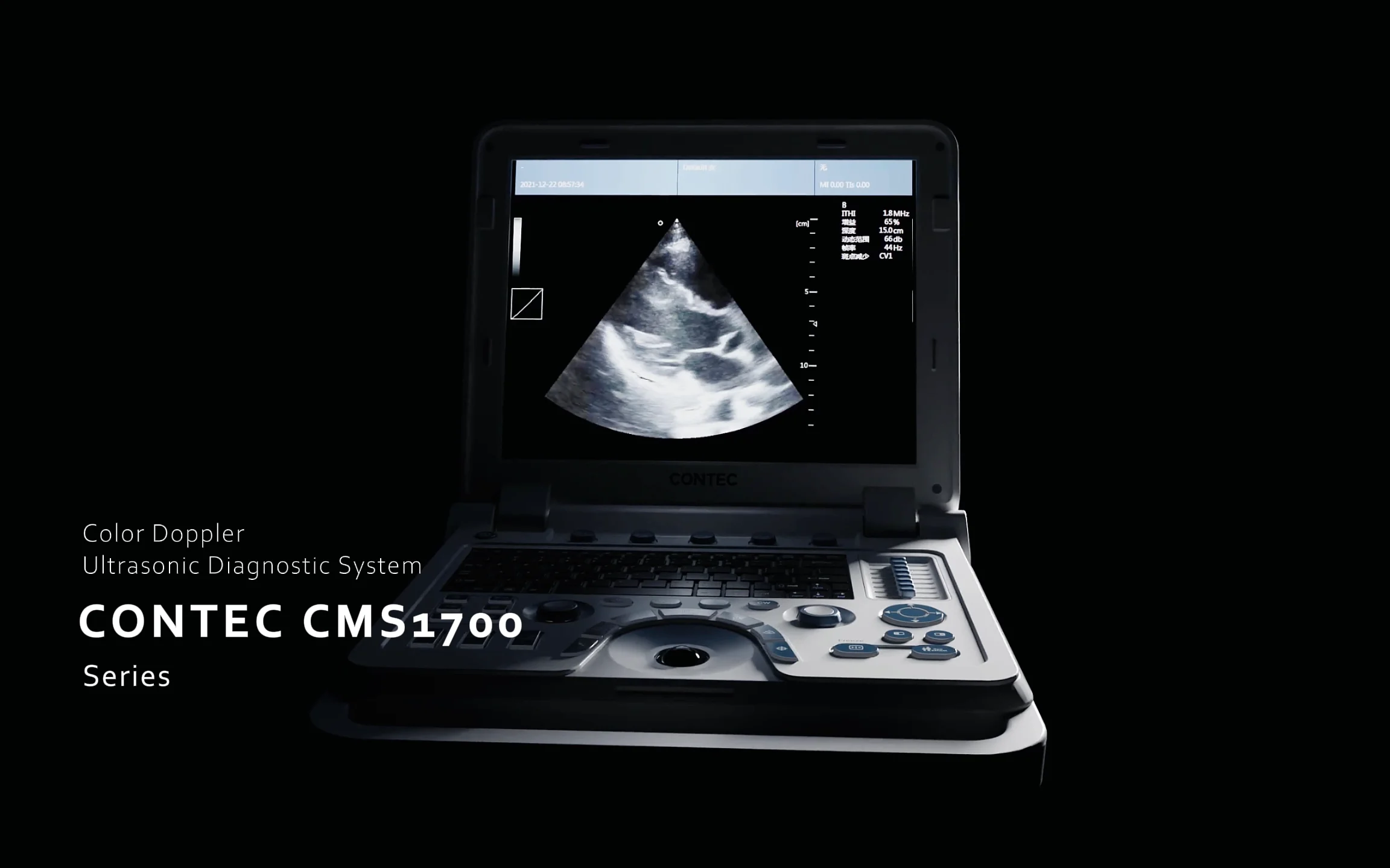 Contec-transductor De Matriz Escalonada,Sistema De Diagnóstico ...