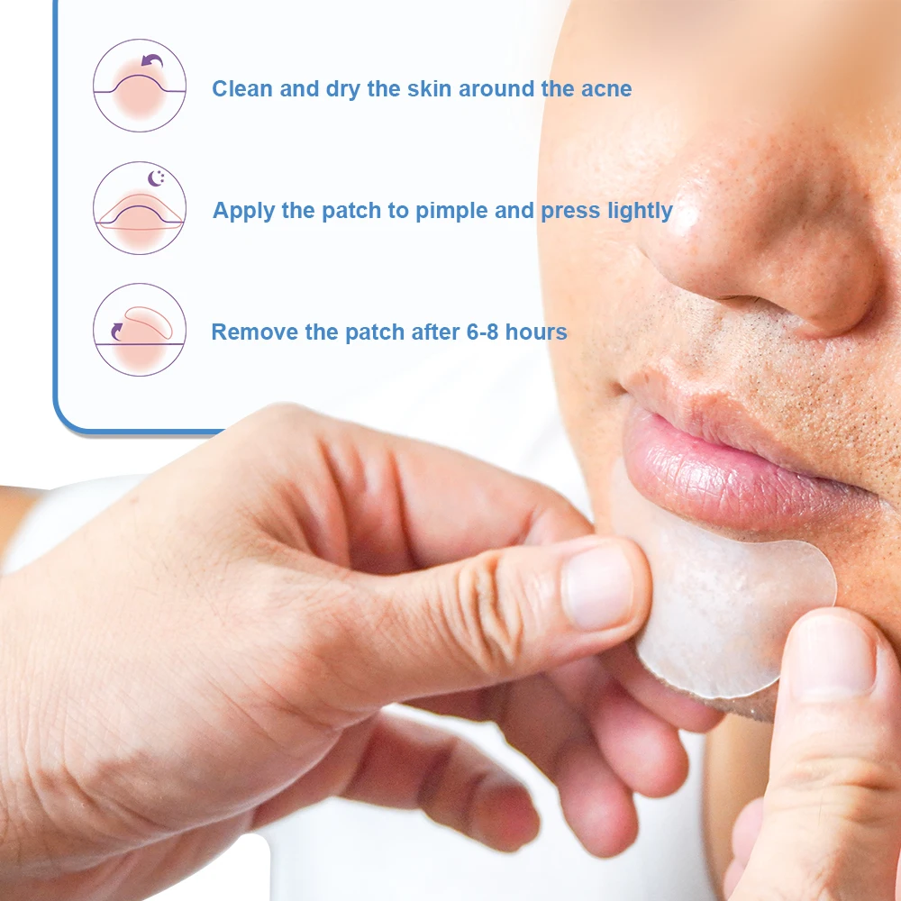 XL Large Pimple Patch, Hydrocolloid Mask for Nose, Chin, Forehead ...