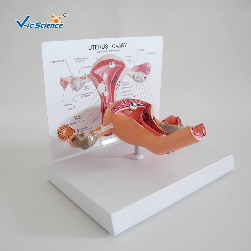 Anatomical Uterus Model - Medical Science Pathology Tool