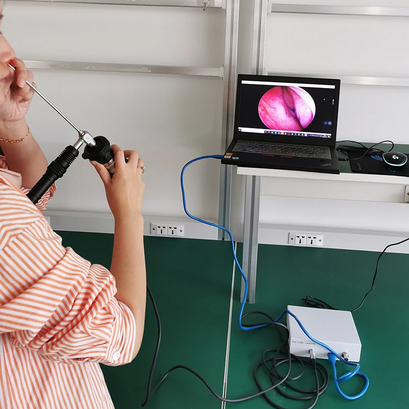 Medical Endoscope USB Borescope Portable Endoscope Camera