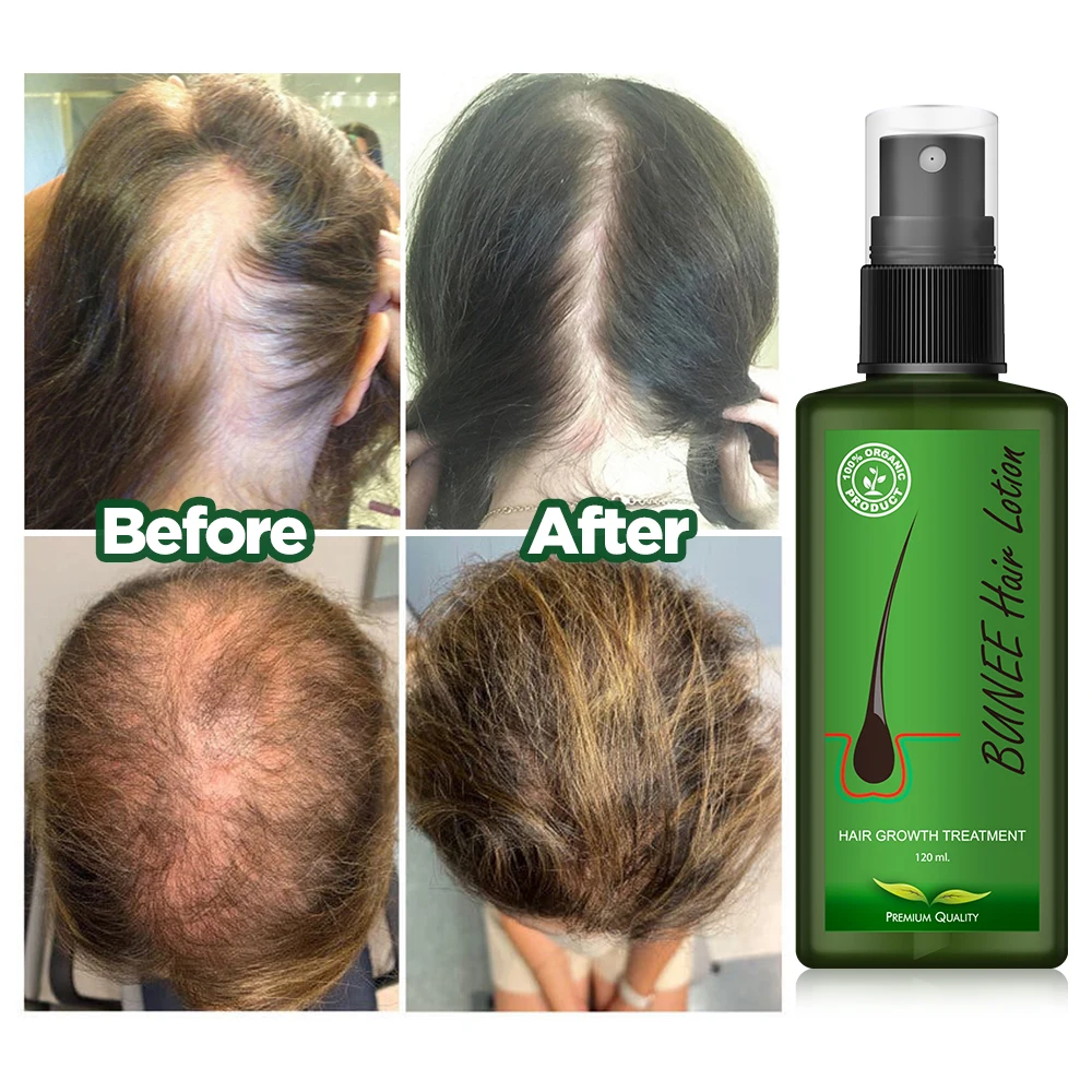 BUNEE Hair Growth Serum - Organic Tonic with Ginger & Rosemary