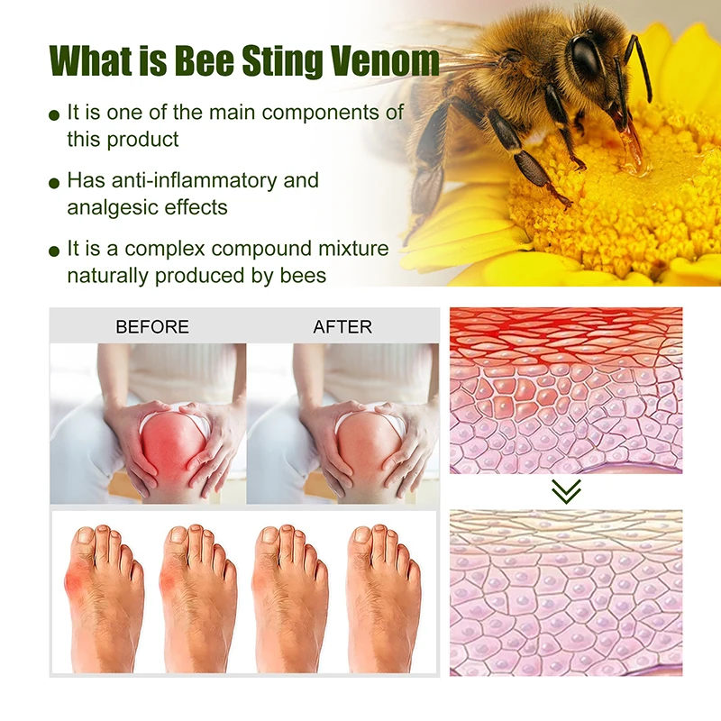 Plant Formula Joint Bone Bee Stings Relief Cream Injury Relieving Knee ...