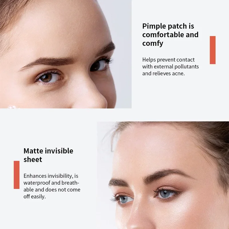 36pcs Pimple Patches Customize Logo Mighty Pimple Patch Private Label ...