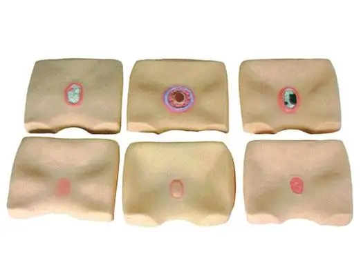 Buttock Skin Decubitus Ulcers Simulator for Nursing Training