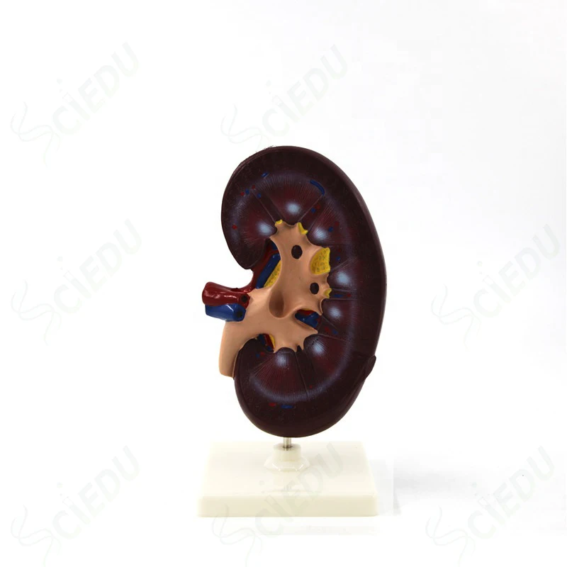 Medical Science Anatomy Kidney Model Teaching Resource Aids Anatomy ...