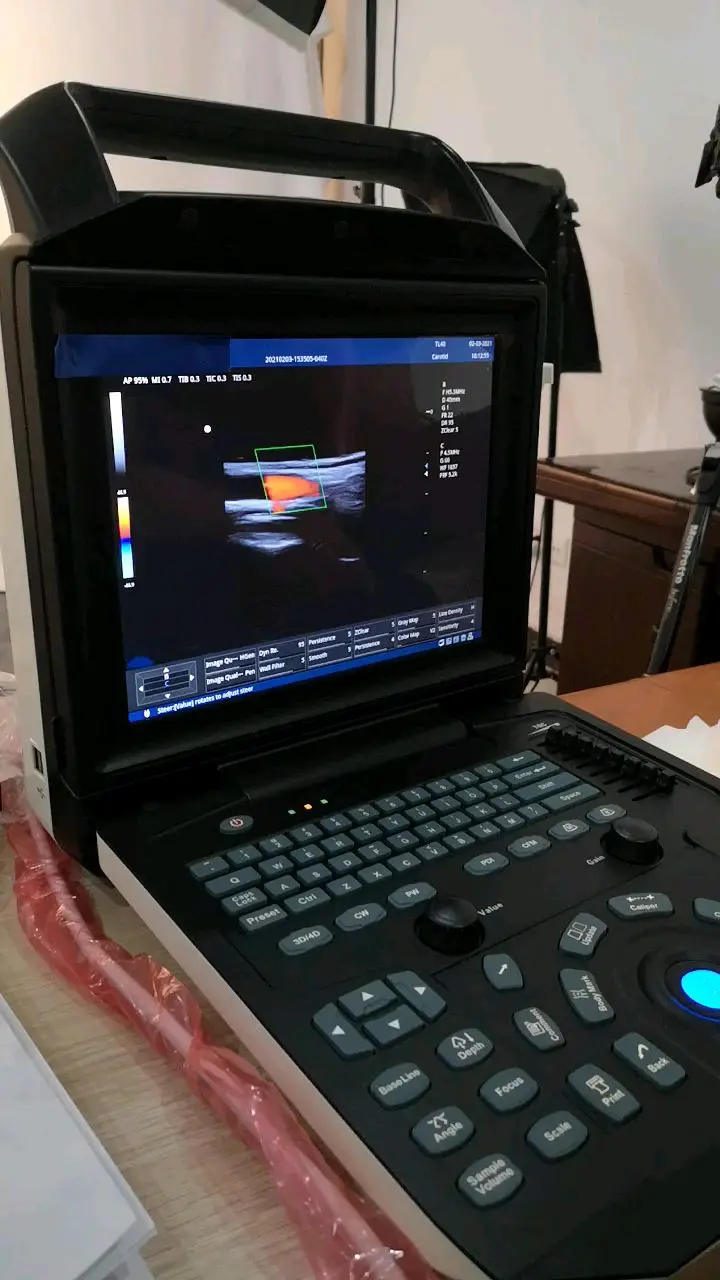 Alibaba.com: Zoncare M5 Portable Handheld 3D Ultrasound Machine for ...