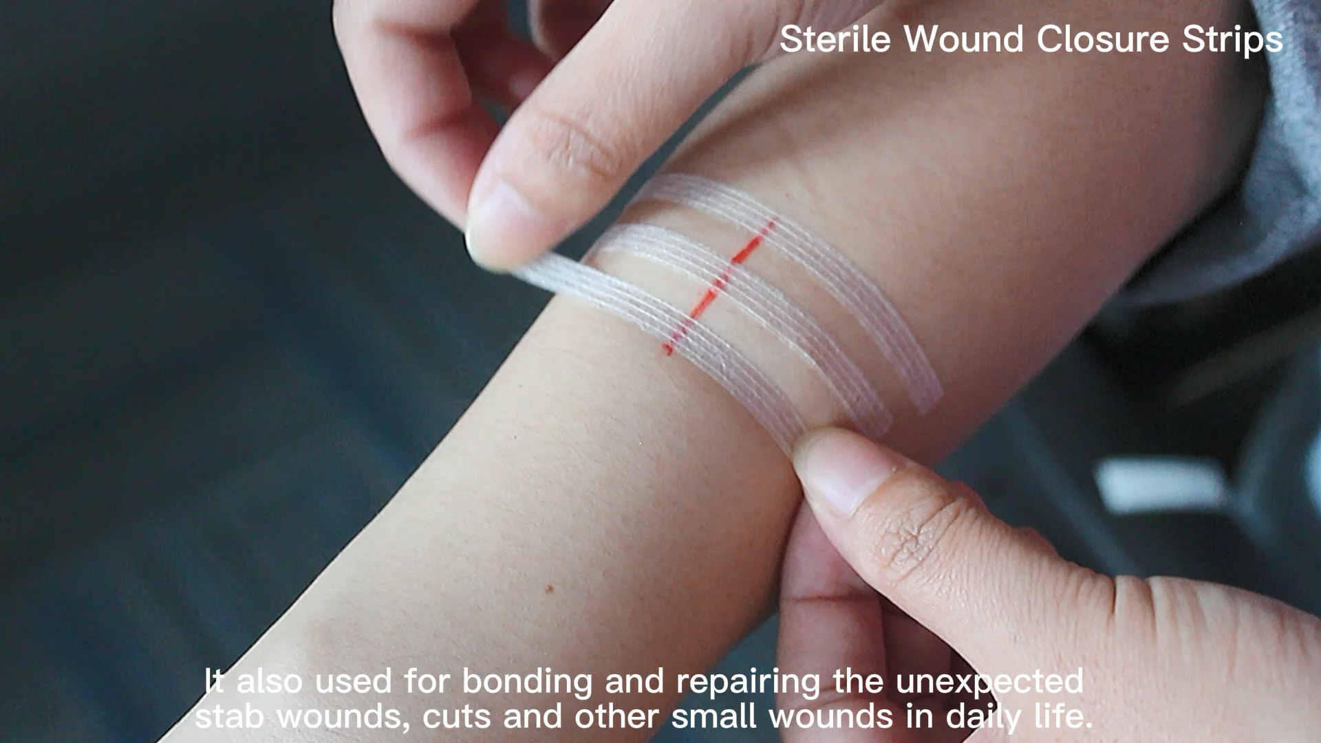Best Quality Hospital Surgical Sterile Wound Closure Strips Steri-strip ...