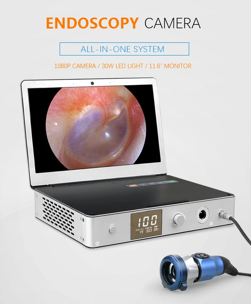 Camjoy Medical CMOS Portable Endoscopy Video Camera HD