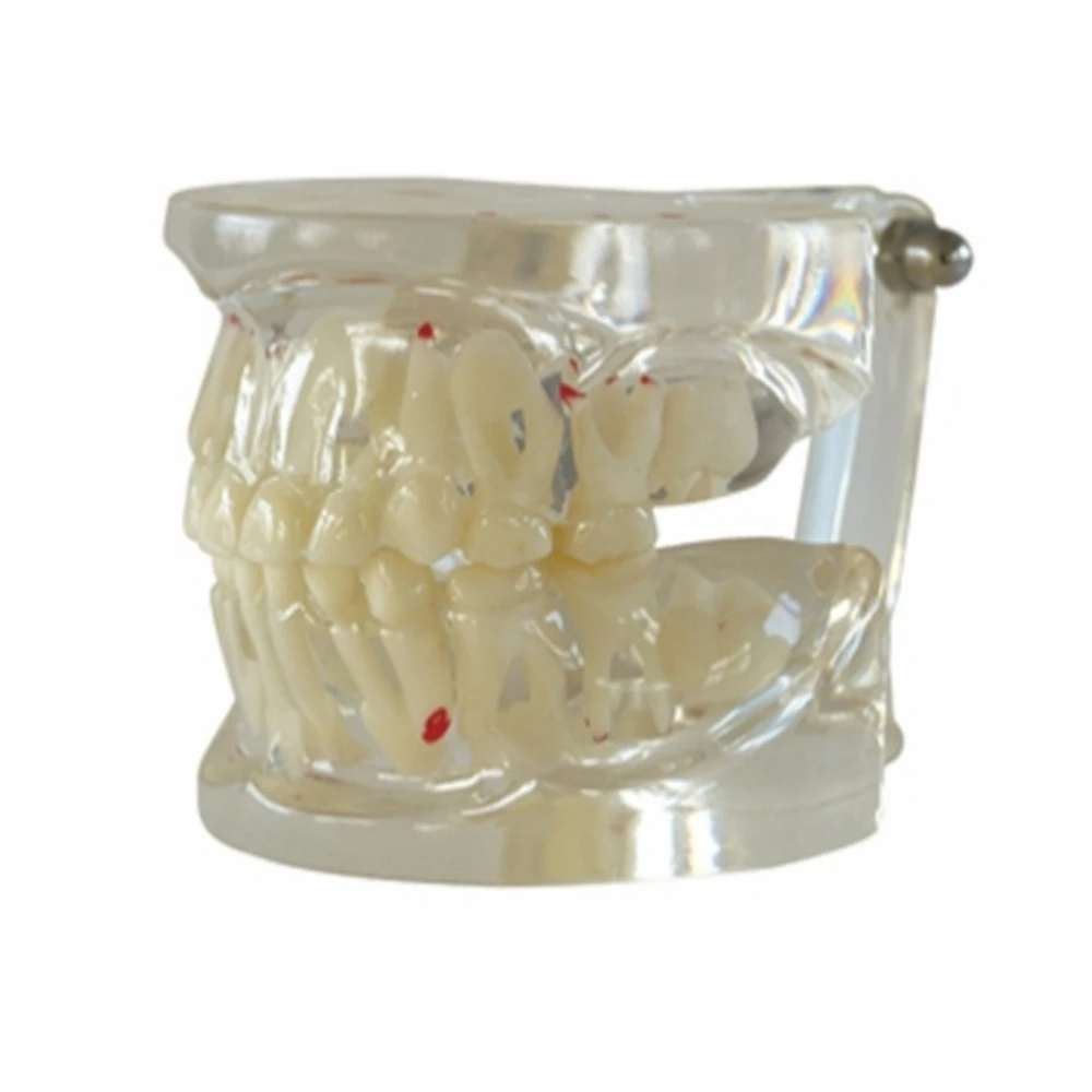 Dental Pathology Model Clear Mixed Age Teeth Study Model - Buy Dental ...