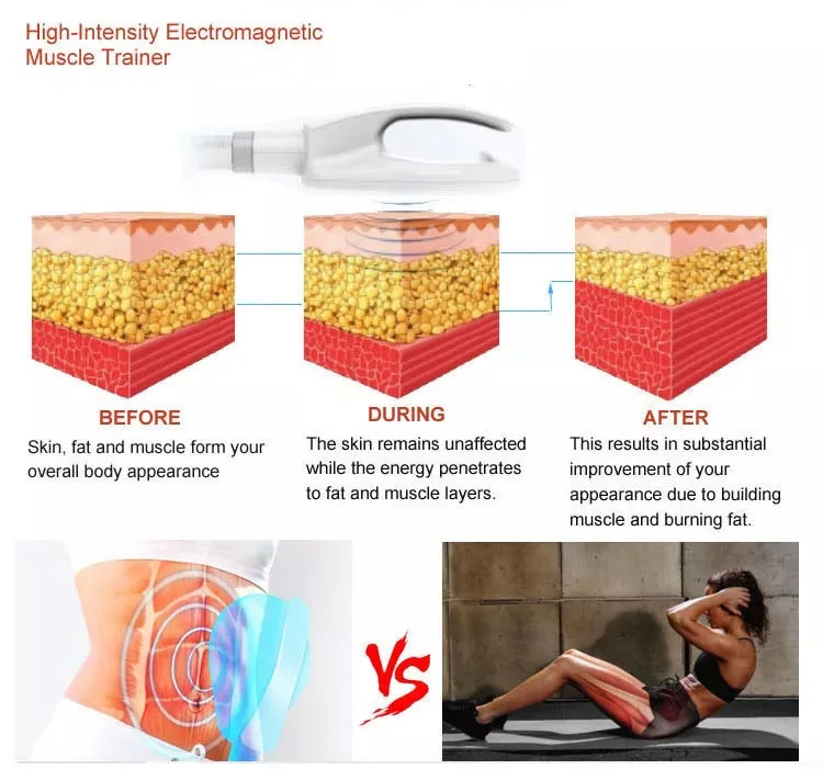 Em Sprt Sculpt Ems Tesla Electromagnetic Muscle Stimulation Body Sculpt ...