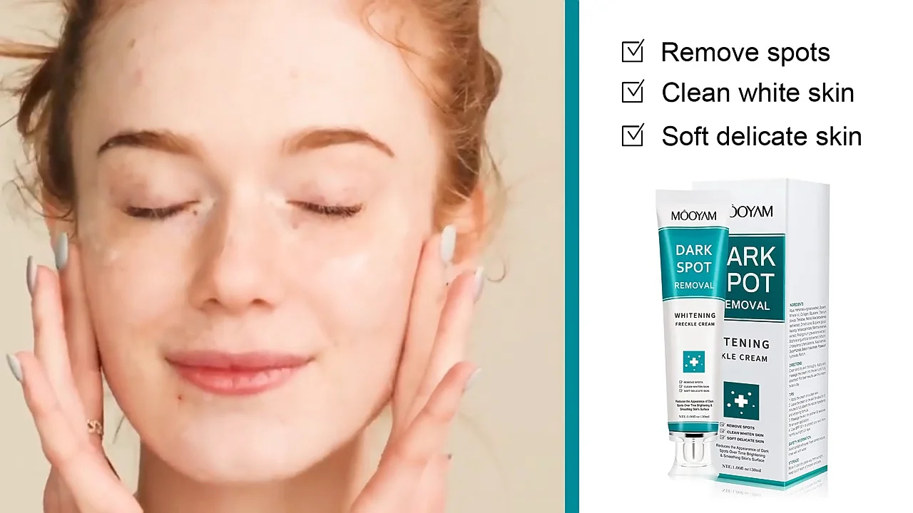 Strong Effective Whitening Freckle Cream Face Remove Melasma Dark Spots ...
