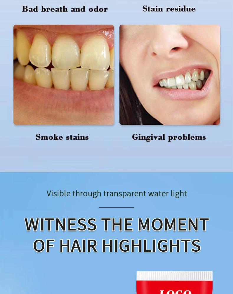 Factory Wholesale Price Probiotic Herbal Teeth Cleaning Whitening Anti ...