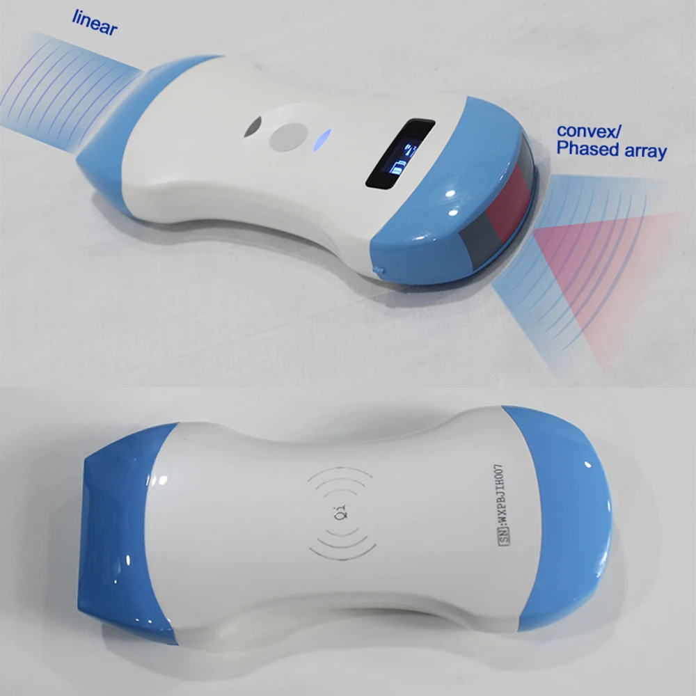 Suresult Wireless Transvaginal Ultrasound Probe - Konted C10 Android