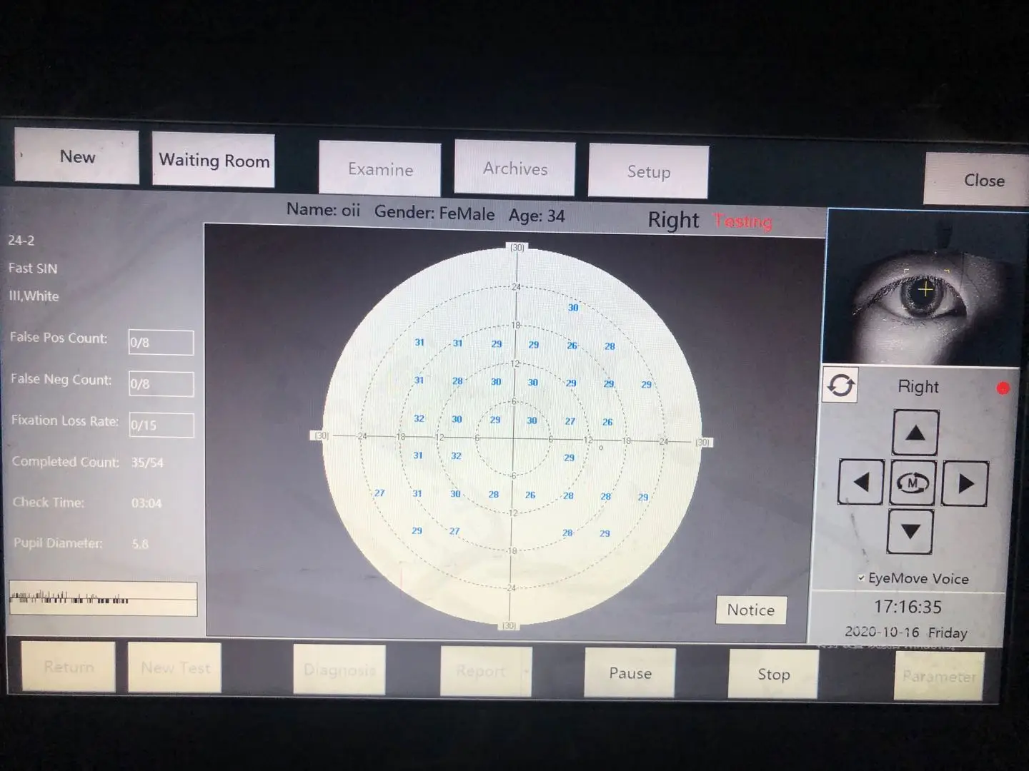 Auto Perimeter CE ISO Ophthalmic Visual Field Screening Machine