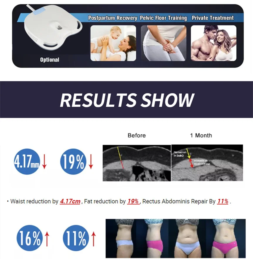 4 Rf Handles Bodysculpt Electromagnetic Muscle Stimulation Body ...