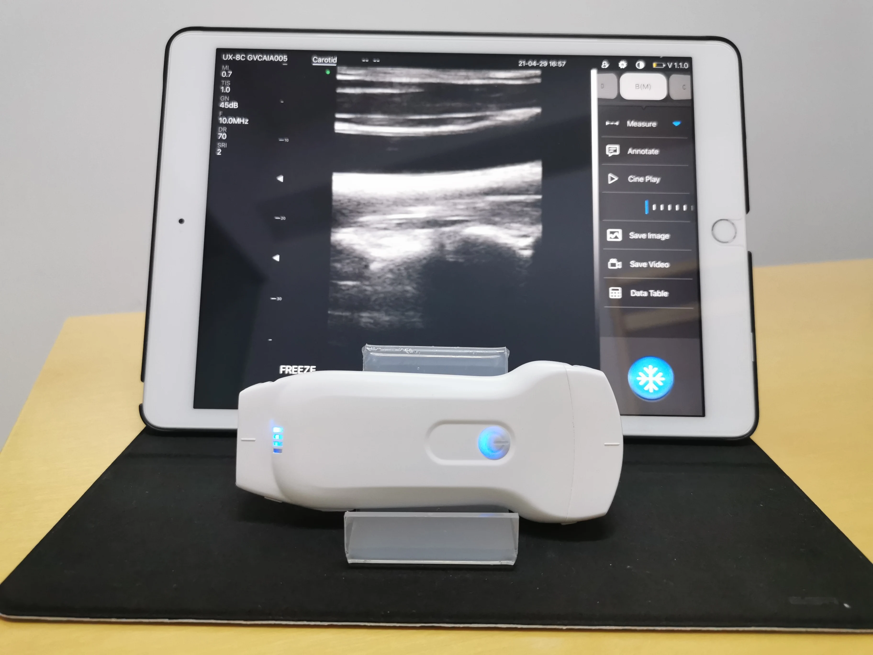 3 in 1 Linear Convex Double Probes - Portable Ultrasound