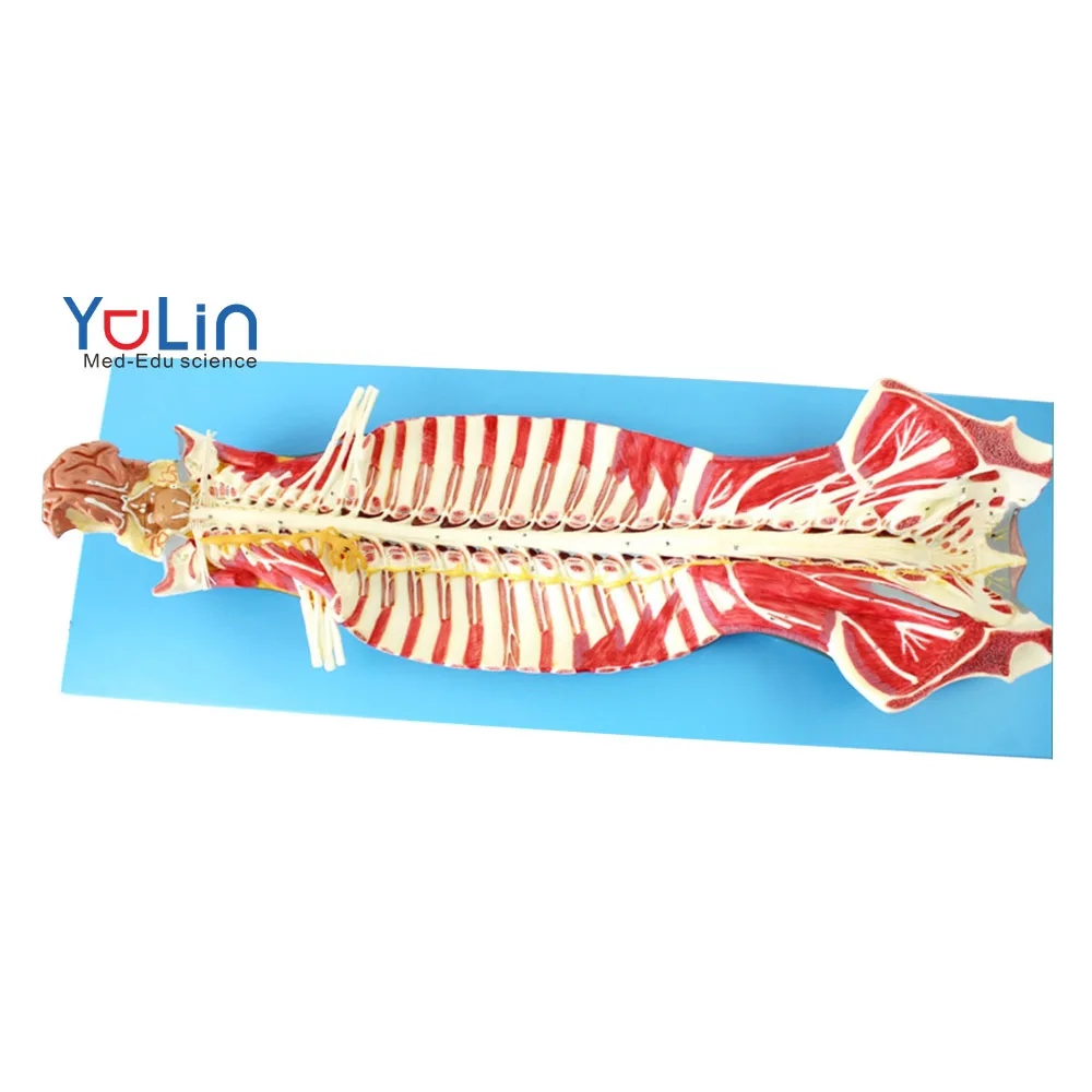 Medical Human Spine Anatomical Model Spinal Nerve Anesthesia Spinal And ...